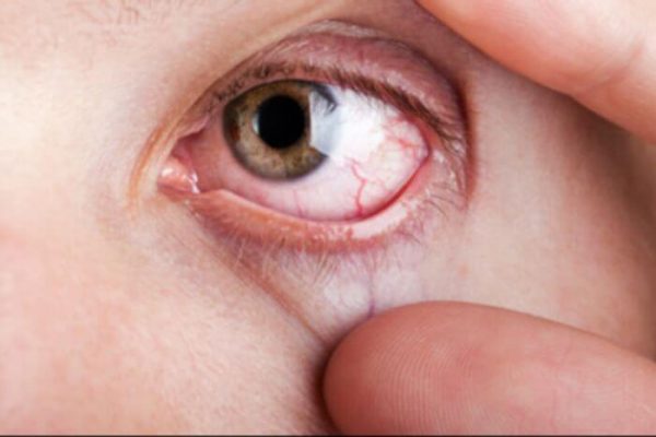 can-diabetic-eye-disease-occur-even-if-my-vision-is-normal-providence