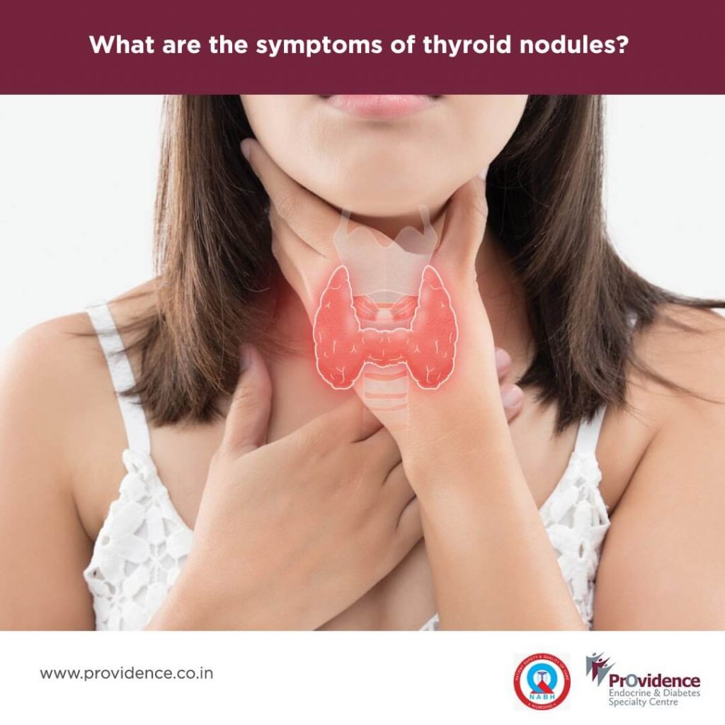 What Are The Symptoms Of Thyroid Nodules Thyroid Lump Symptoms