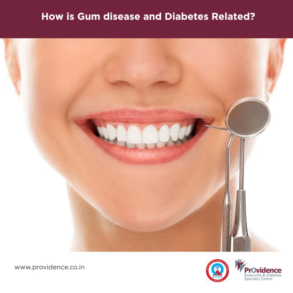 How is Gum Disease & Diabetes Related? | Gum Disease and Diabetes