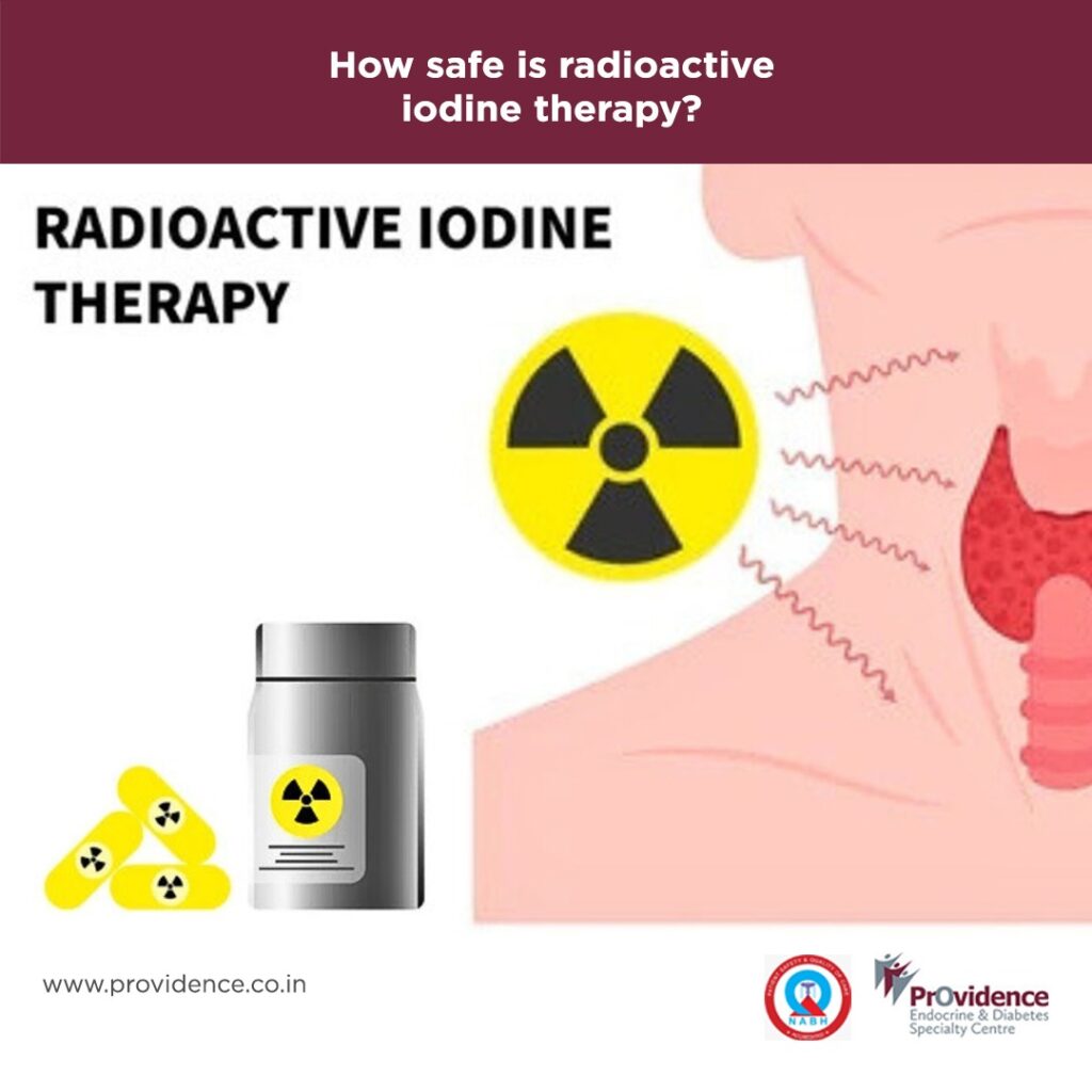 How safe is radioactive iodine therapy?