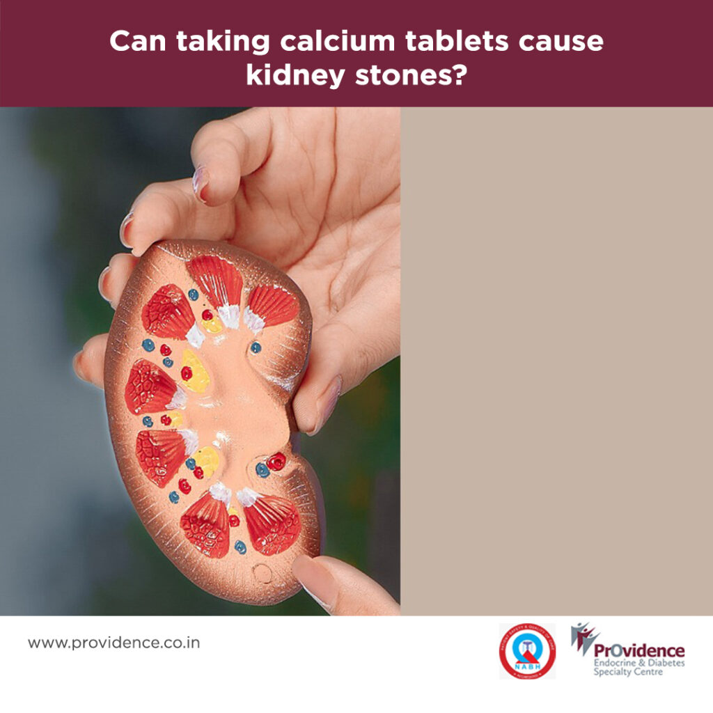 Can taking calcium tablets cause kidney stones?